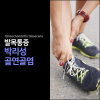 발목 박리성 골연골염 발목통증 발목염좌 발목연골손상 서울정형외과 내과 종합검진센터 네이버 블로그